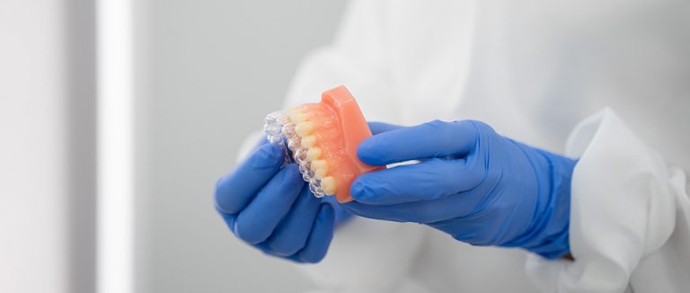 ¿Qué son las férulas dentales? - Quality Dent